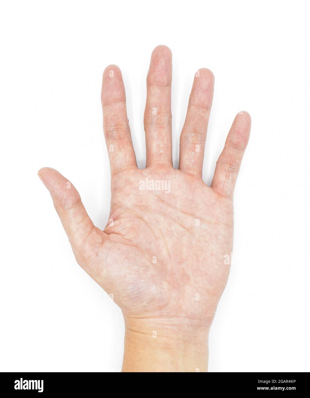 Sweaty hand of Asian young man. Isolated on white background Stock ...