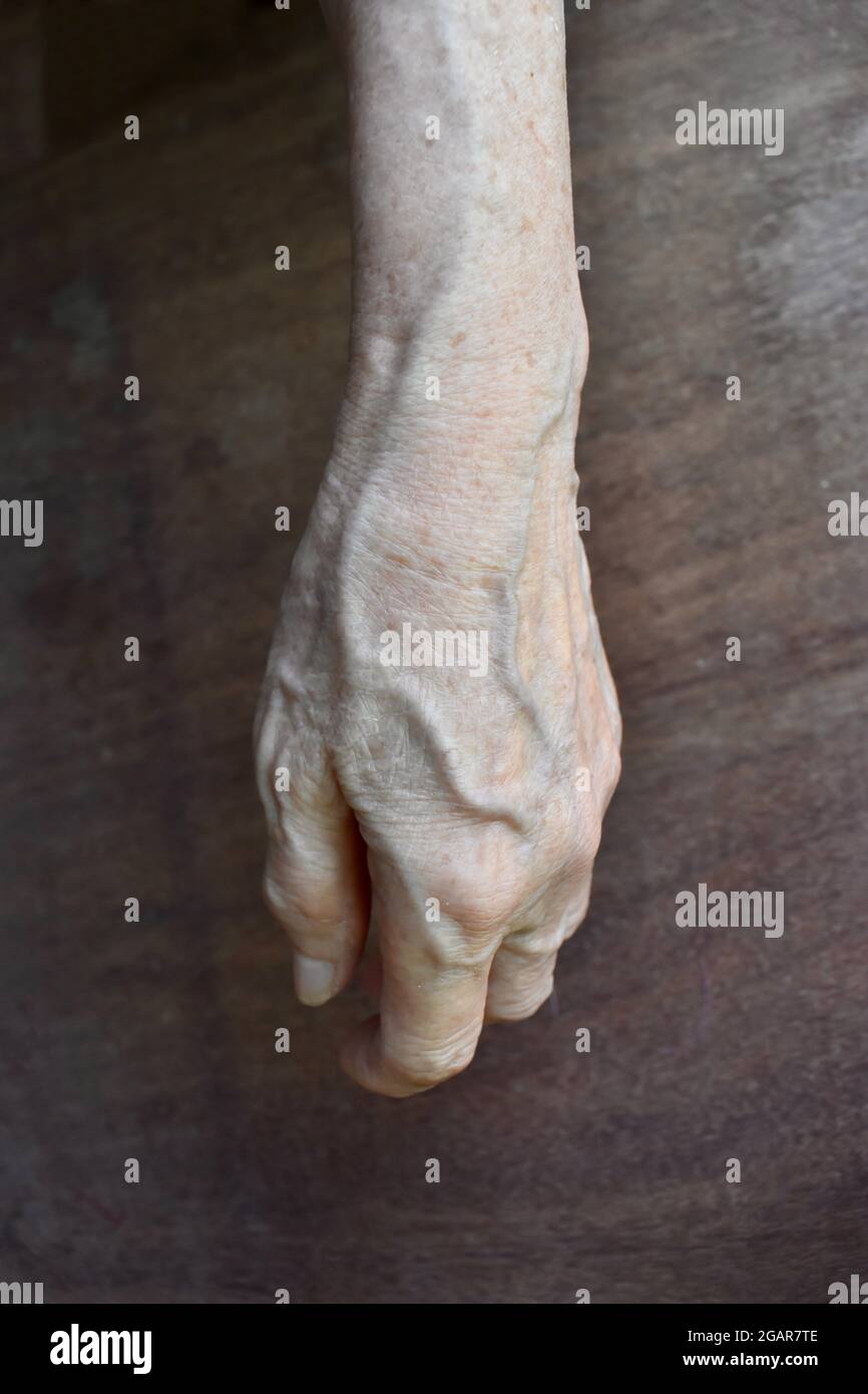 Southeast Asian, Myanmar old woman’s hand. Skin creases, loosen skin ...