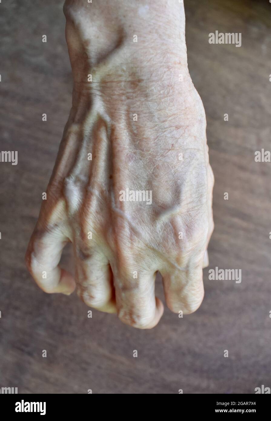 Southeast Asian, Myanmar old woman’s hand. Skin creases, loosen skin ...