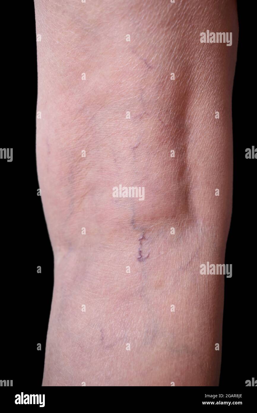 Black skin on ankle hi-res stock photography and images - Alamy