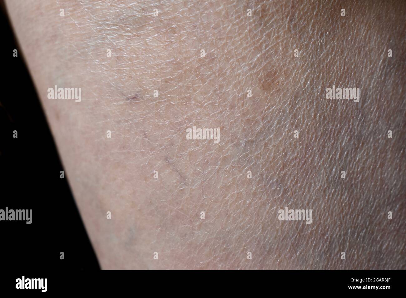 Aging skin folds or skin creases or wrinkles at thigh of Southeast ...