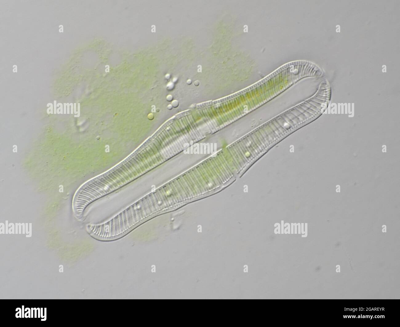 Freshwater diatom, Rhopalodia sp., about 80 microns in length, under ...