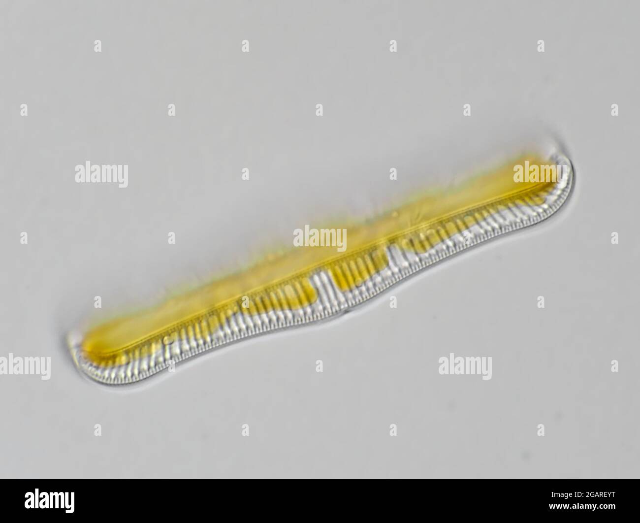 Freshwater diatom, Rhopalodia sp., under the microscope Stock Photo - Alamy