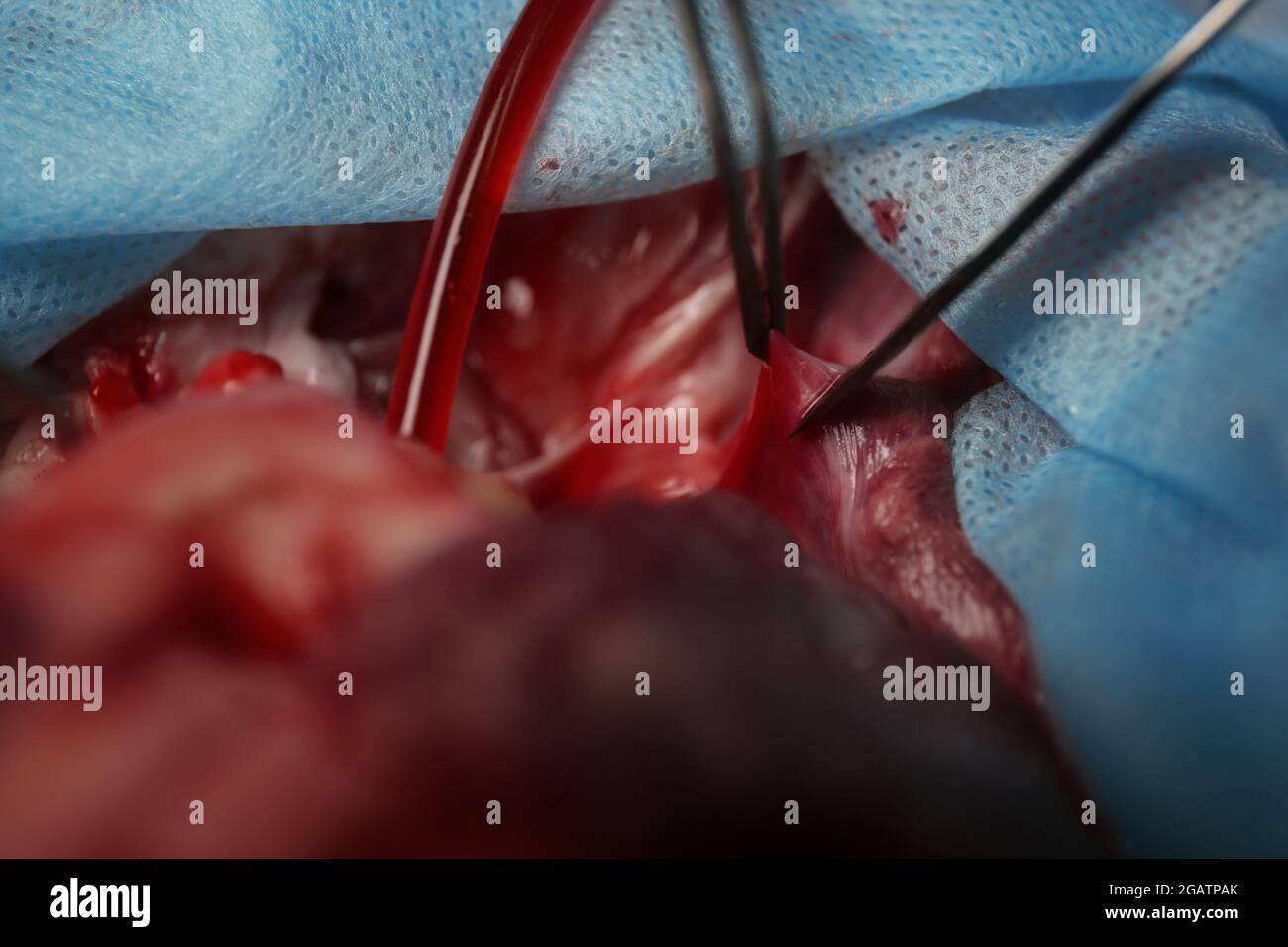 Heart operation closeup Stock Photo - Alamy