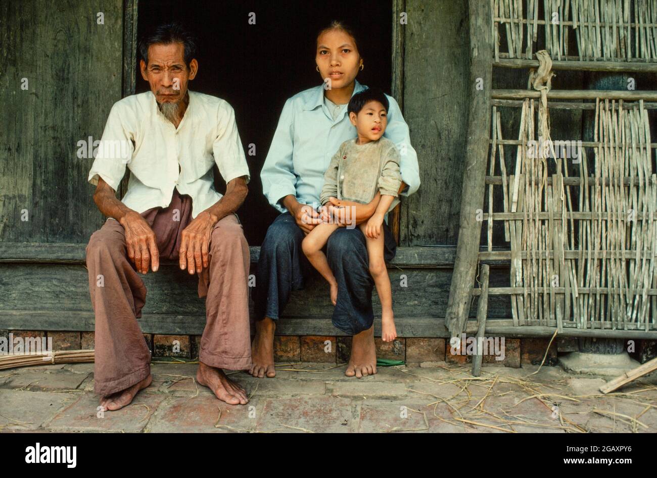 Quyen is four. She has microcephalia. Quen’s father, Nyguyen Van Quach ...