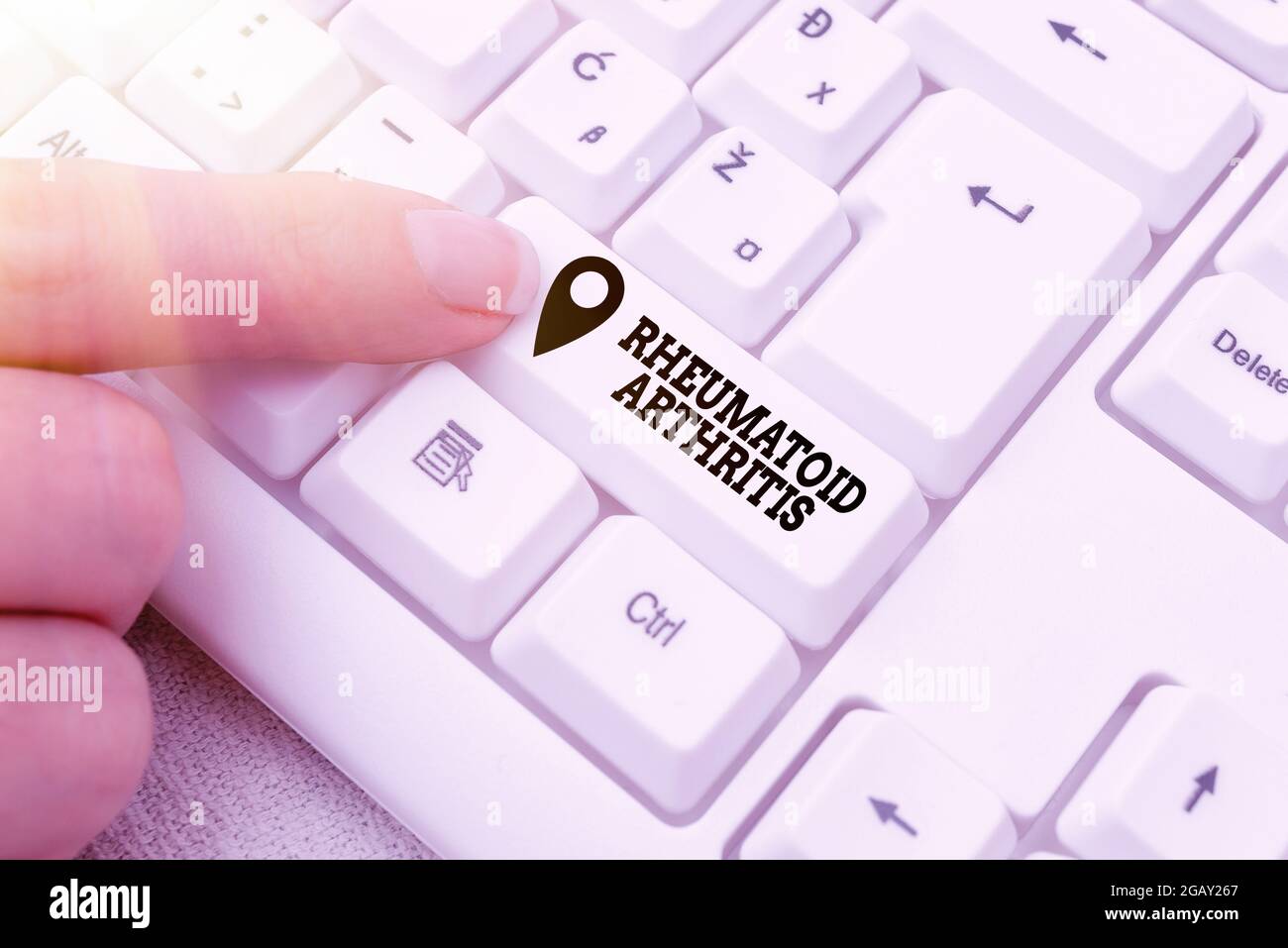 Text showing inspiration Rheumatoid Arthritis. Conceptual photo chronic ...