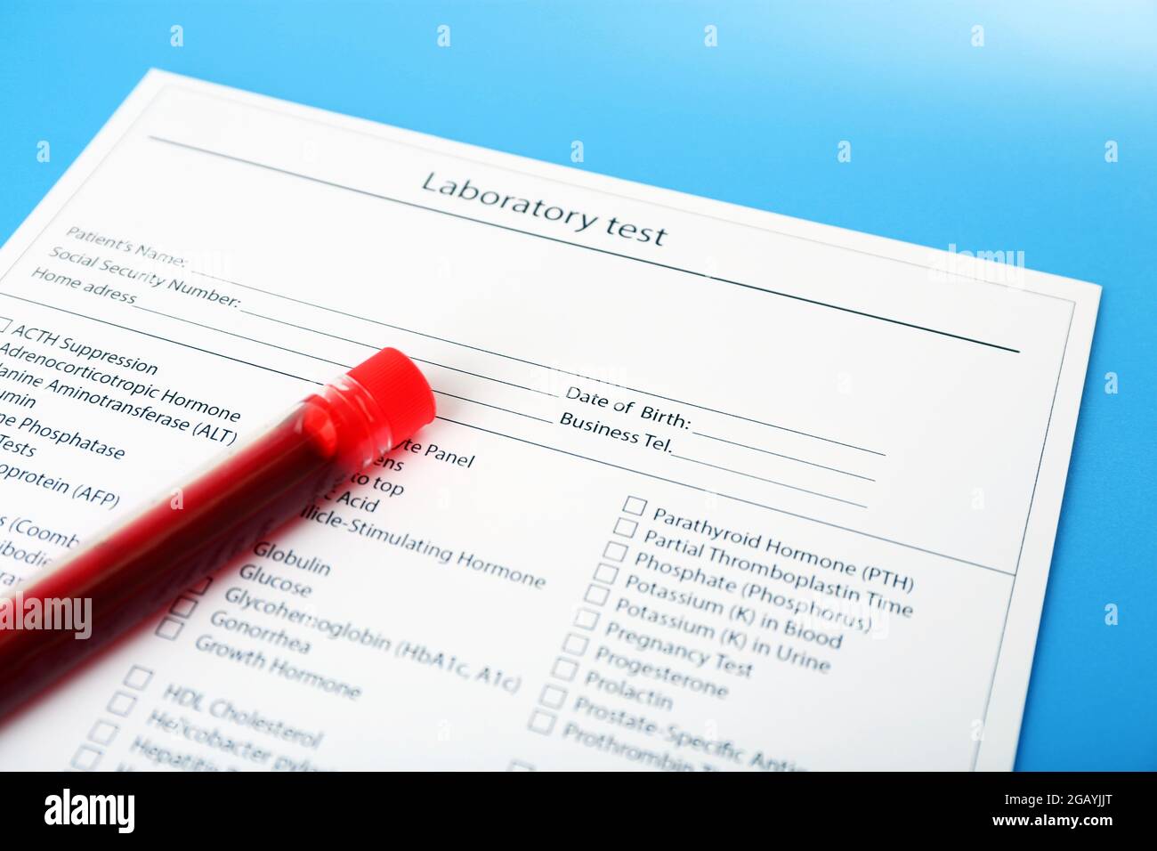 Blood in test tubes and investigation form on the table Stock Photo - Alamy