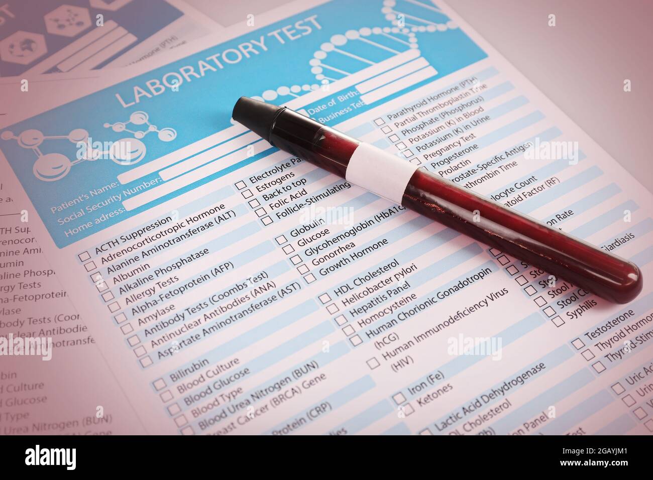 Blood in test tubes and investigation form on the table, close-up Stock ...