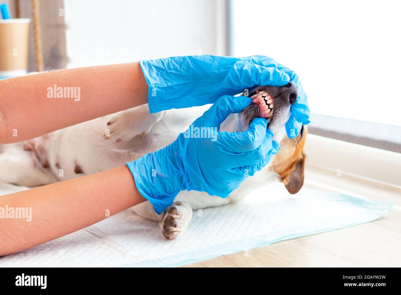 Calculus dental teeth hi-res stock photography and images - Alamy