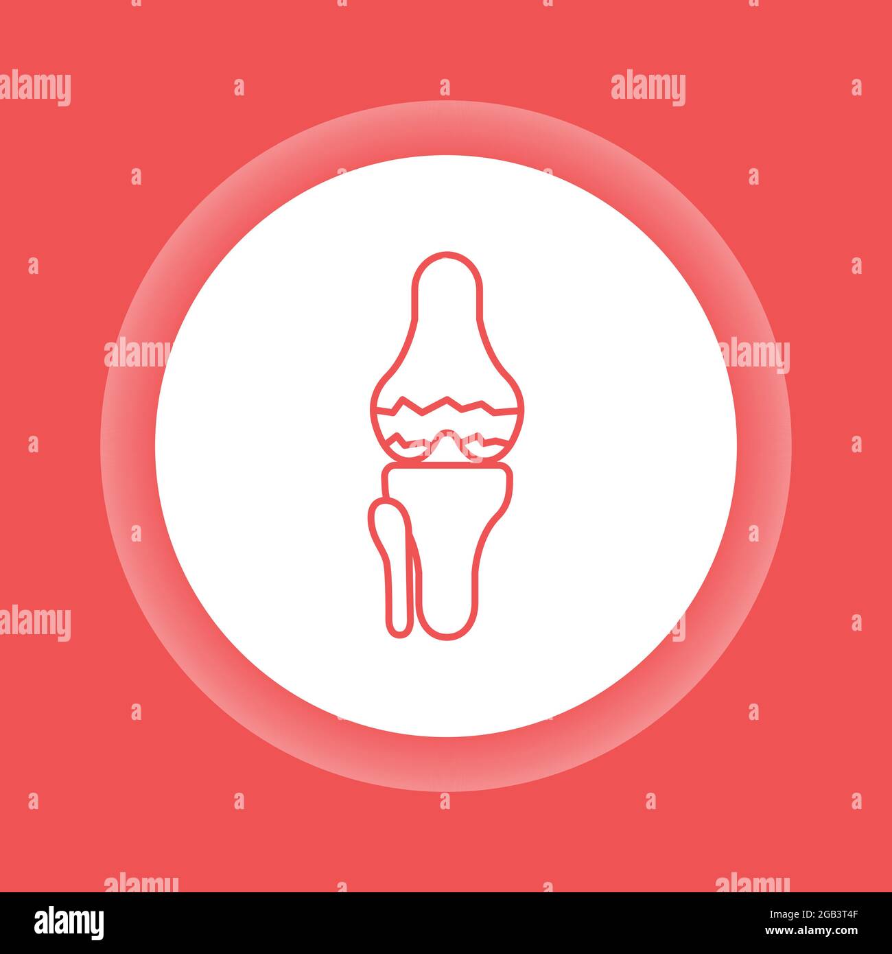 Knee osteoarthritis drawing hi-res stock photography and images - Alamy