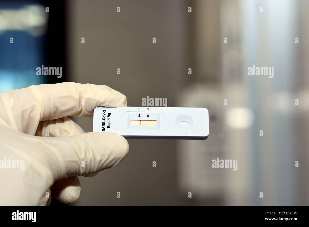 Negative result of SARS-CoV-2 Rapid Antigen AG test done by a nasal ...