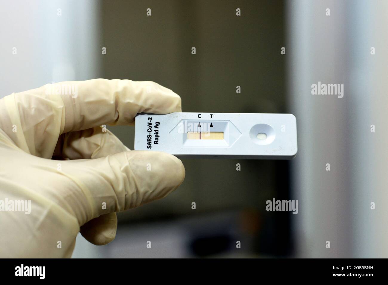 Negative result of SARS-CoV-2 Rapid Antigen AG test done by a nasal ...