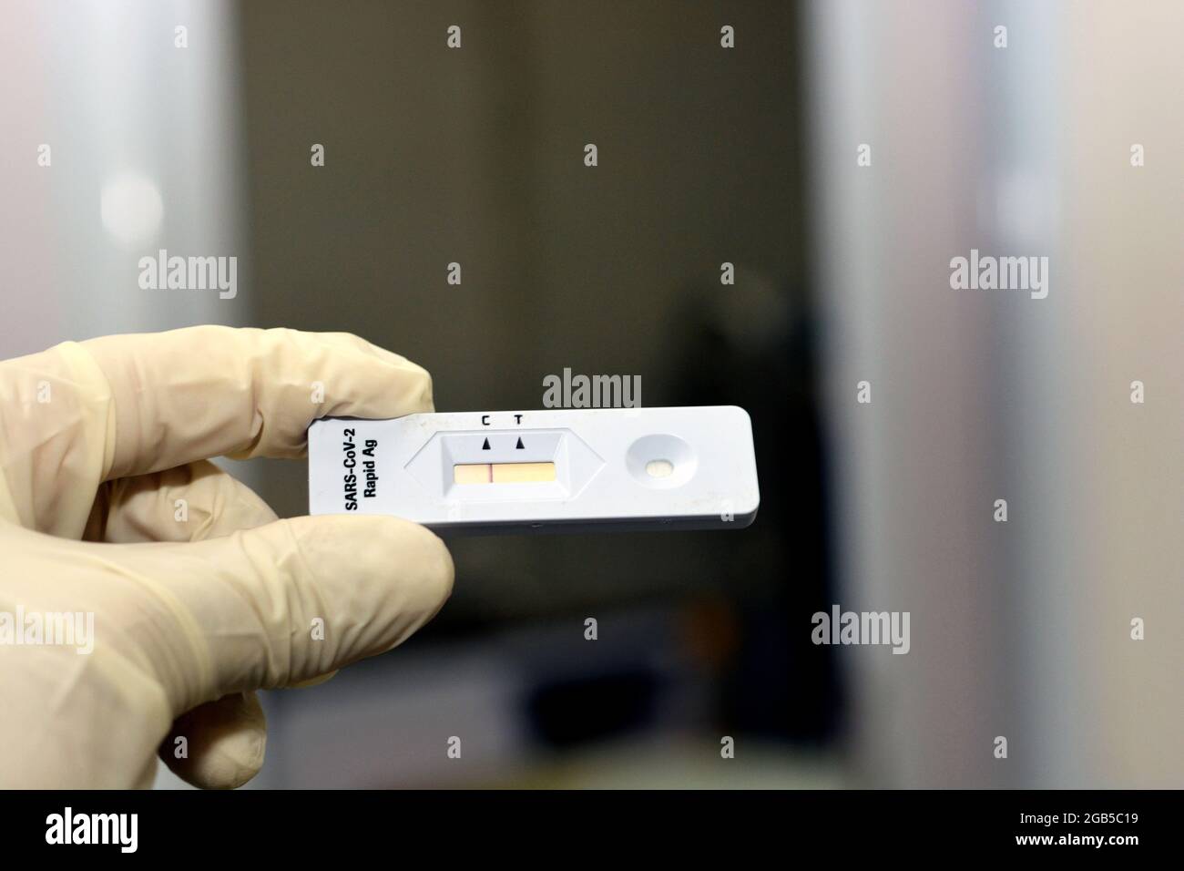 Negative result of SARS-CoV-2 Rapid Antigen AG test done by a nasal ...