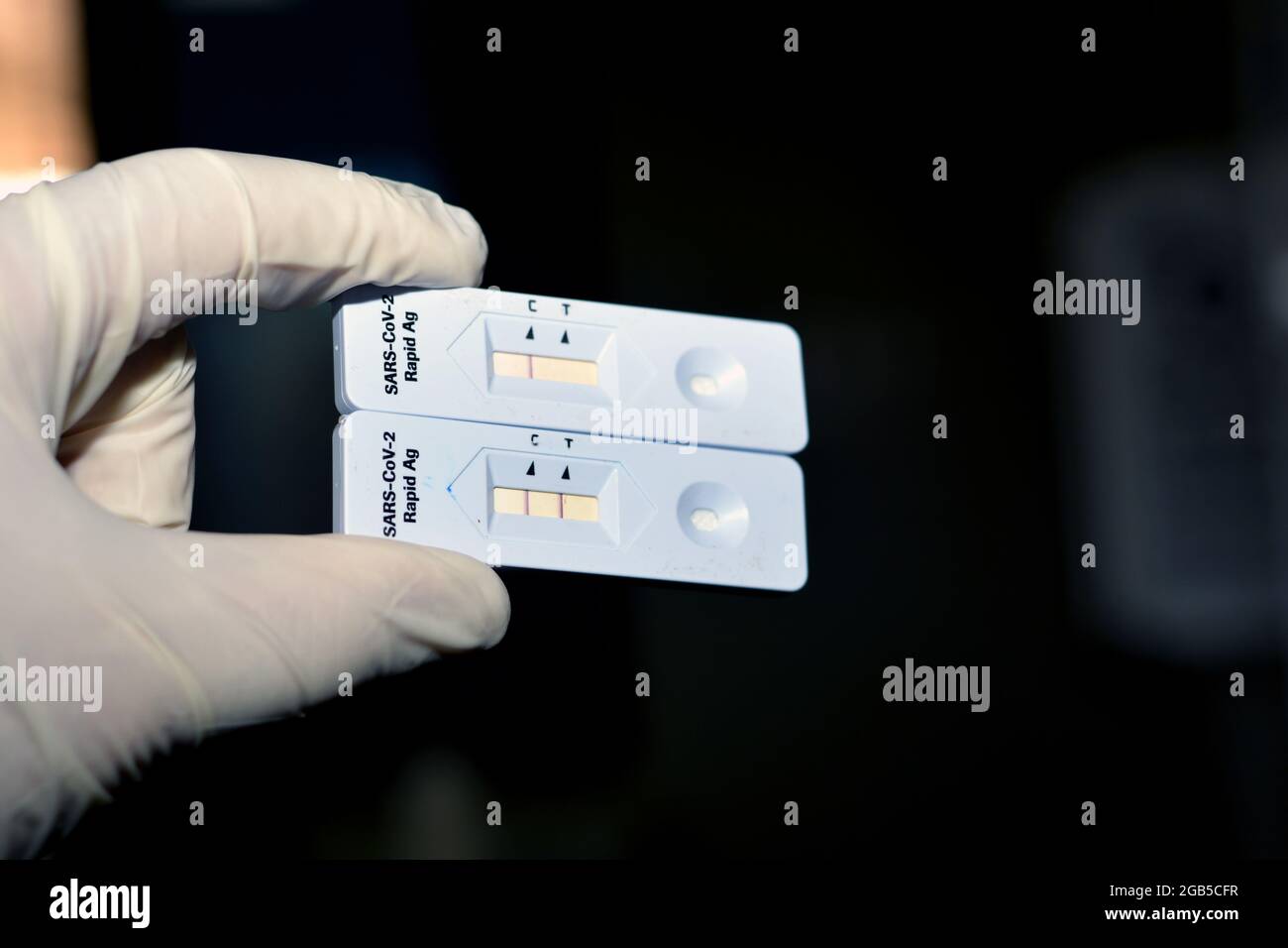 Positive and negative results of SARS-CoV-2 Rapid Antigen AG test done ...