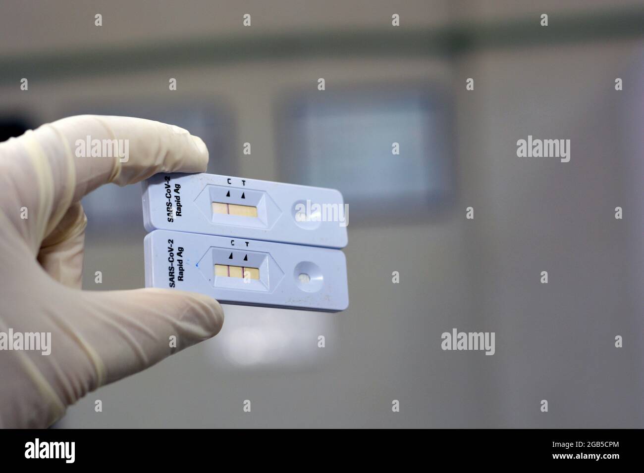 Positive and negative results of SARS-CoV-2 Rapid Antigen AG test done ...