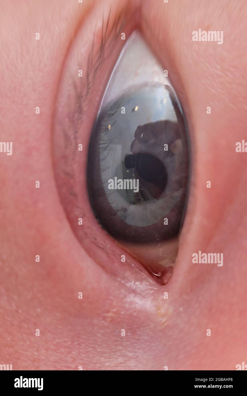 Gray eye of a newborn baby, close-up. Macro photo of a child open eye ...
