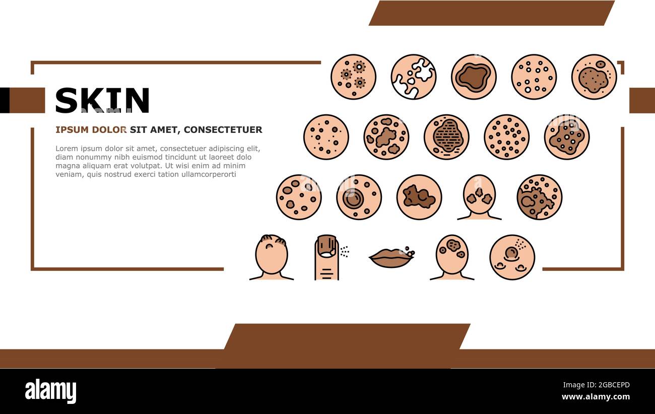 Skin Disease Symptom Landing Header Vector Stock Vector Image And Art Alamy