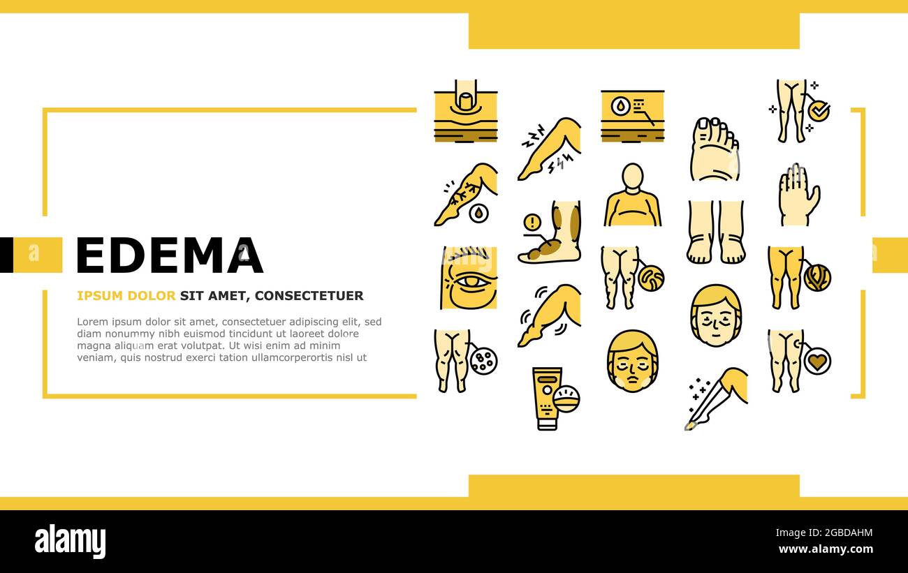 Edema Disease Symptom Landing Header Vector Stock Vector Image And Art