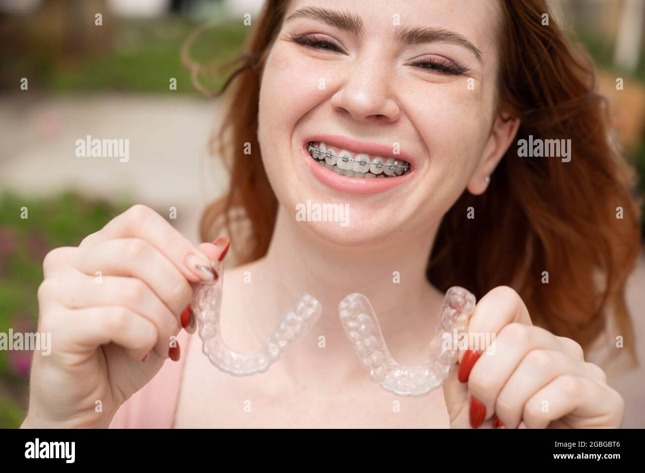 Beautiful young red-haired woman with braces on her teeth holding ...