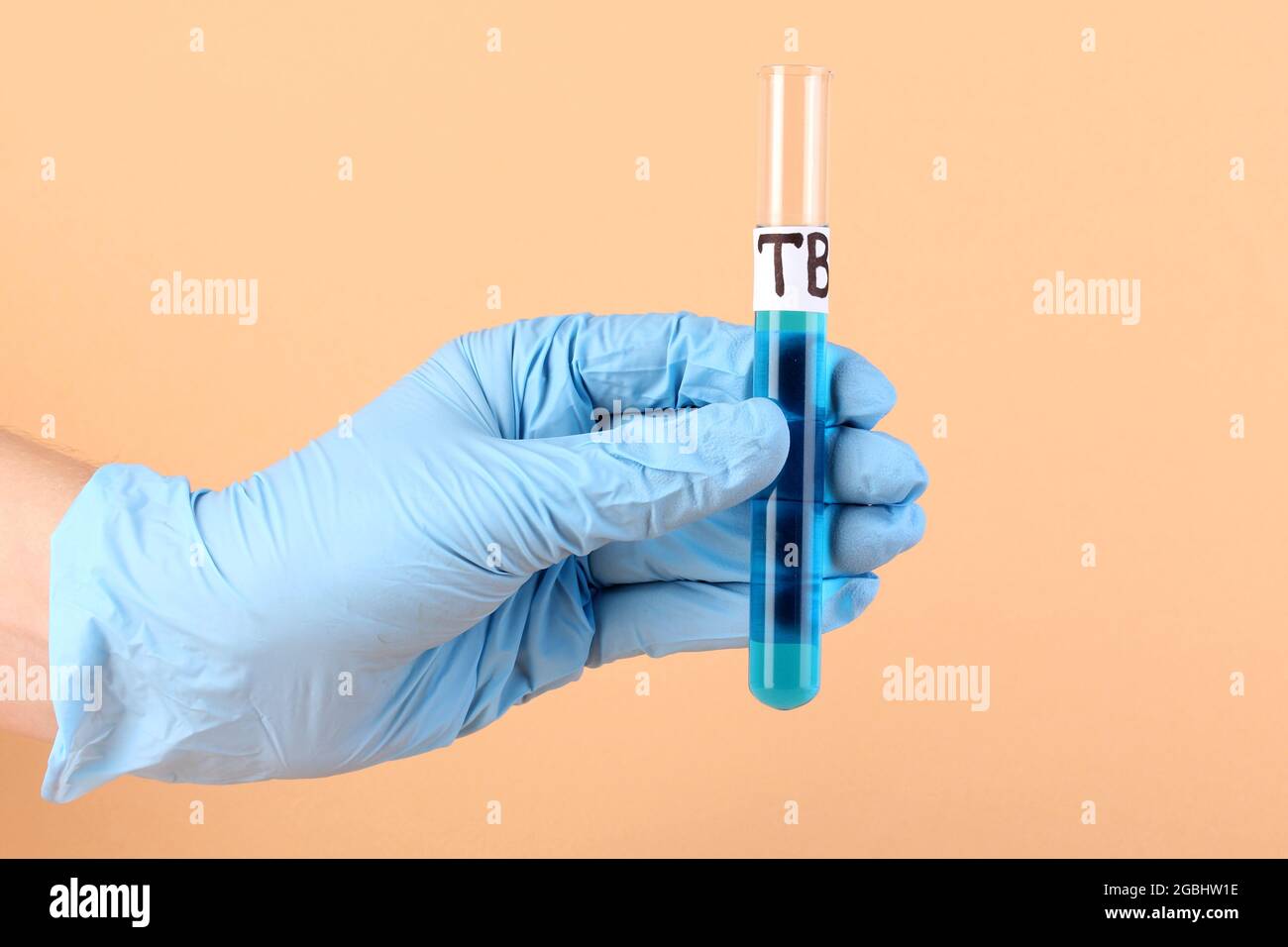 Test tube labeled Tuberculosis(TB) in hand on beige background Stock ...