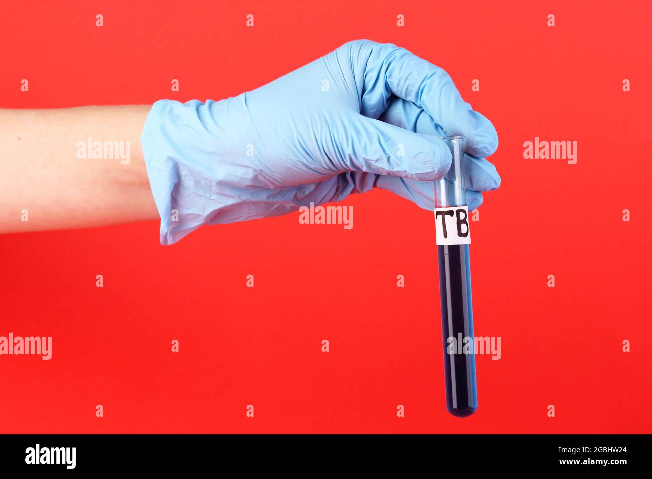 Test tube labeled Tuberculosis(TB) in hand on red background Stock ...