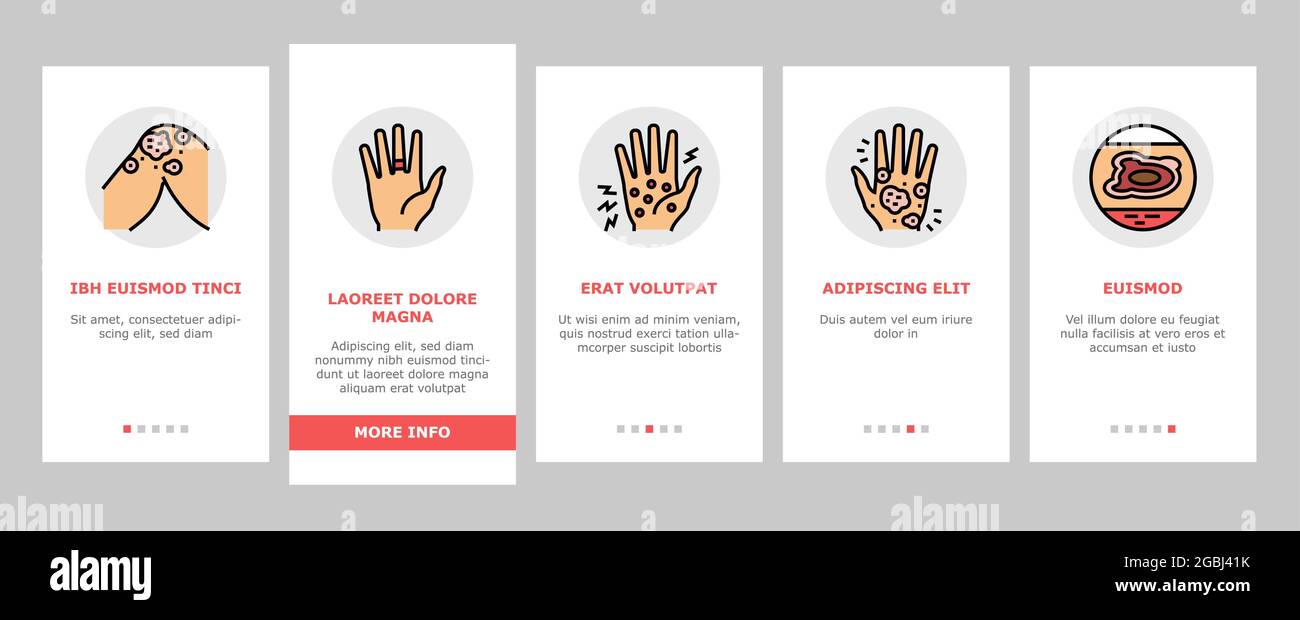 Eczema Disease Treat Onboarding Icons Set Vector Stock Vector Image
