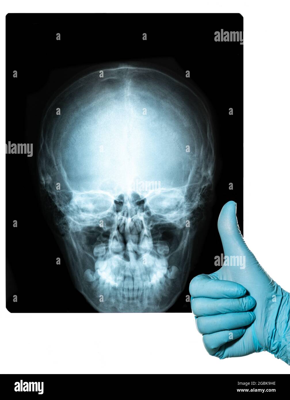 Human skull X-ray image view image hand in glove thumbs up isolated on ...