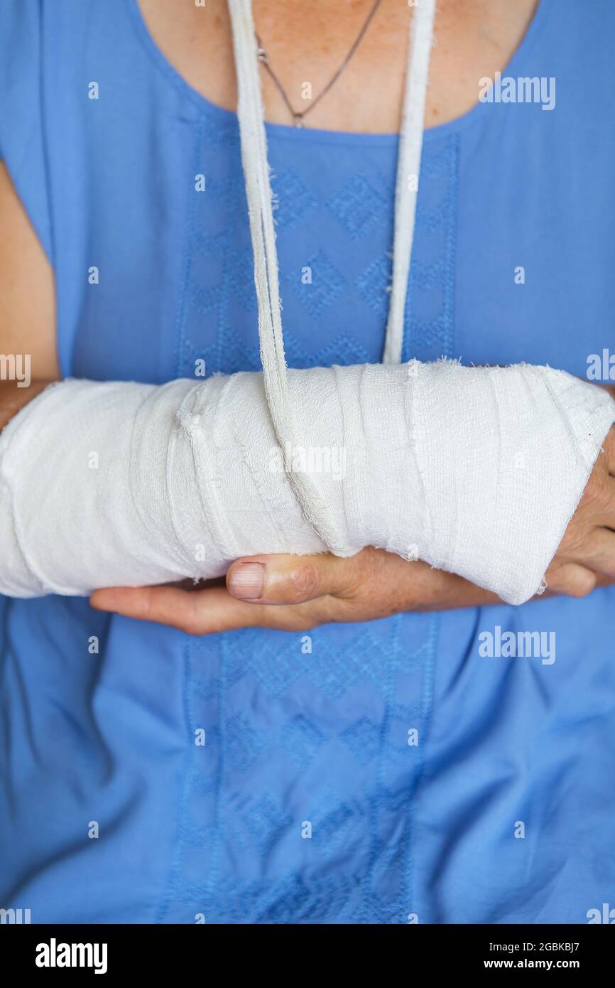 senior woman with a rewound arm in a cast and bandage. Blow, fracture ...