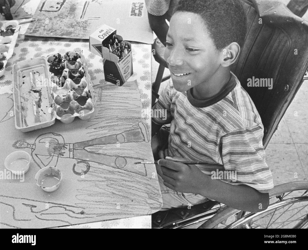 Spina bifida wheelchair hi-res stock photography and images - Alamy