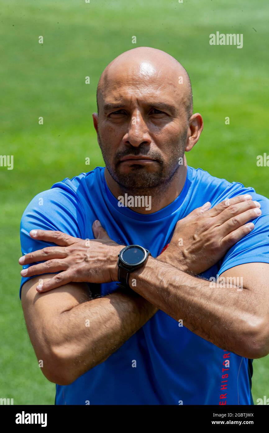 Cruz Azul Bone Sticking Out