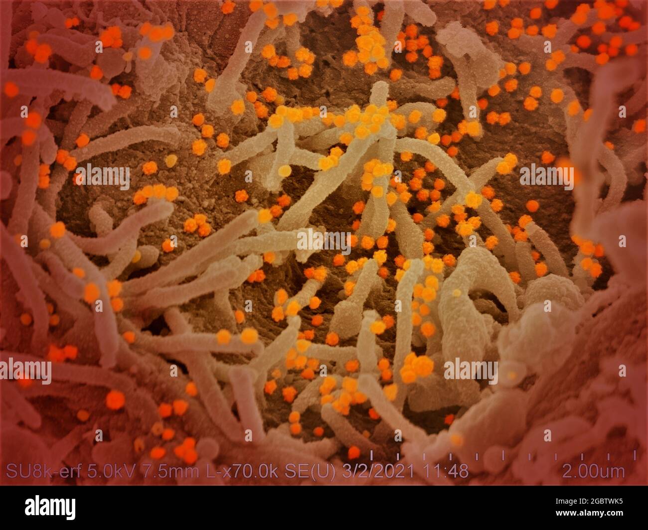 Scanning electron microscope image hi-res stock photography and images ...