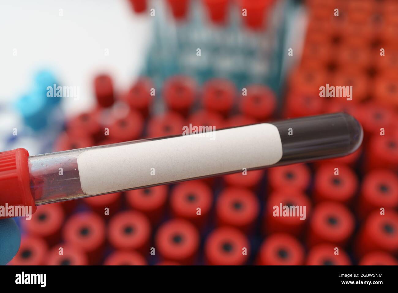 A test tube with a blood sample with empty label in the doctor's hand ...