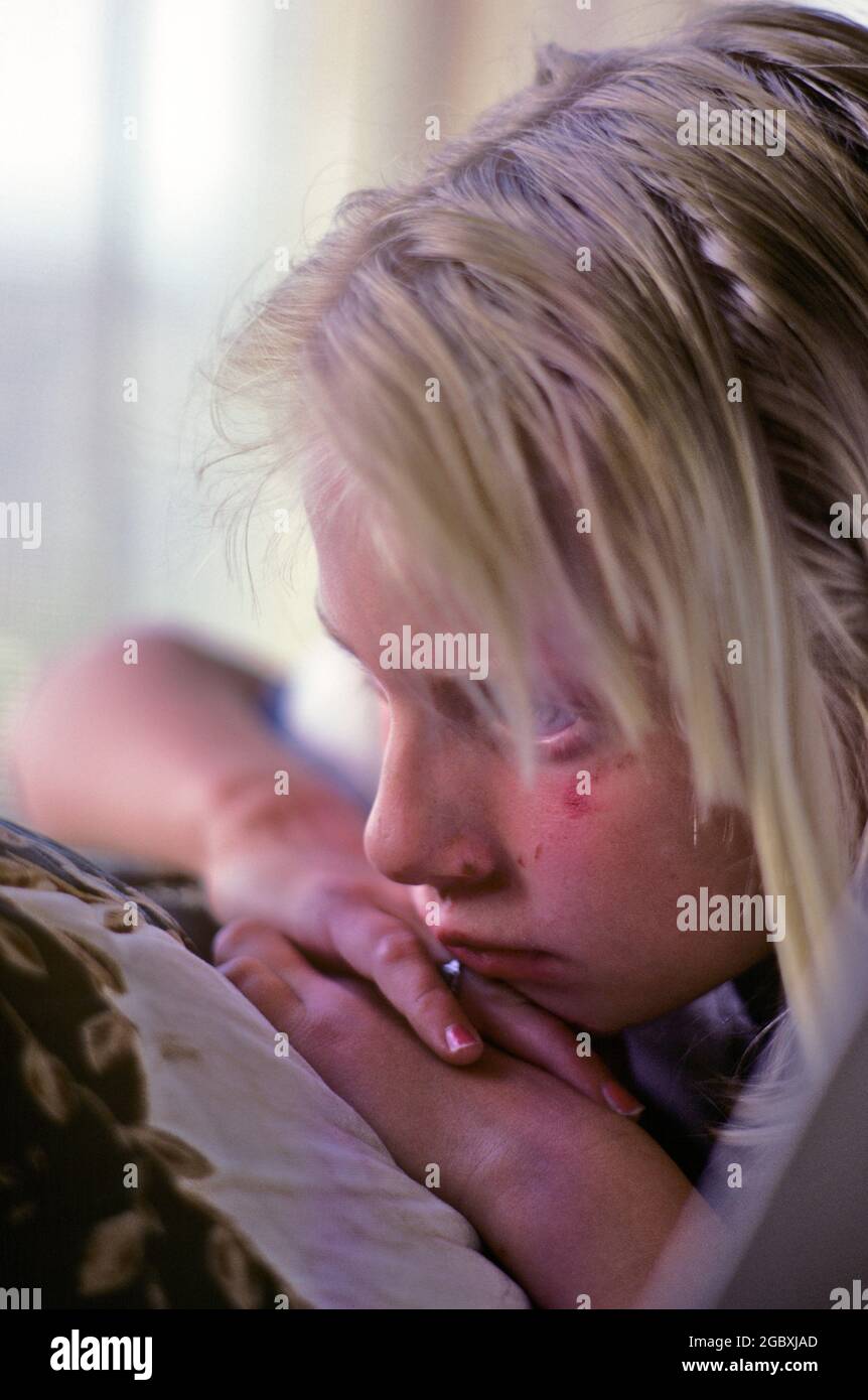 Female bruised face hi-res stock photography and images - Alamy