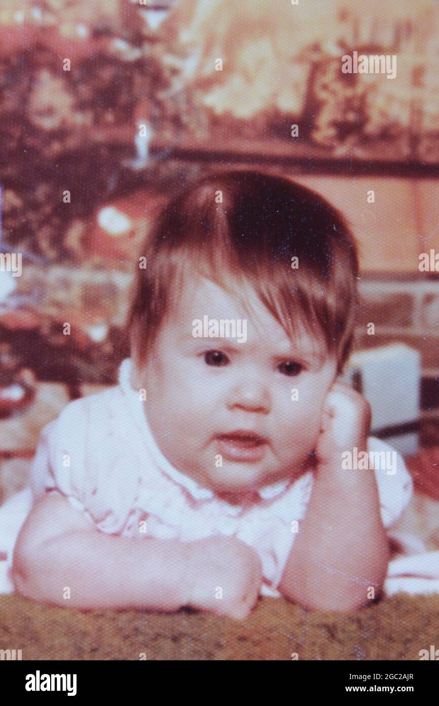 Confused Baby Images