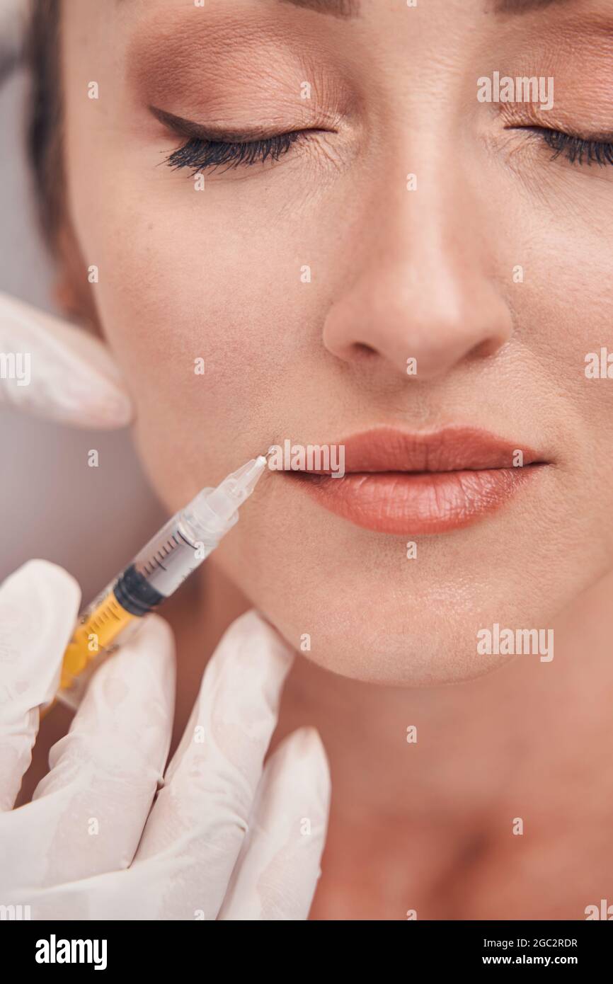 Beautiful lady doing filler injections for nasolabial folds Stock Photo ...