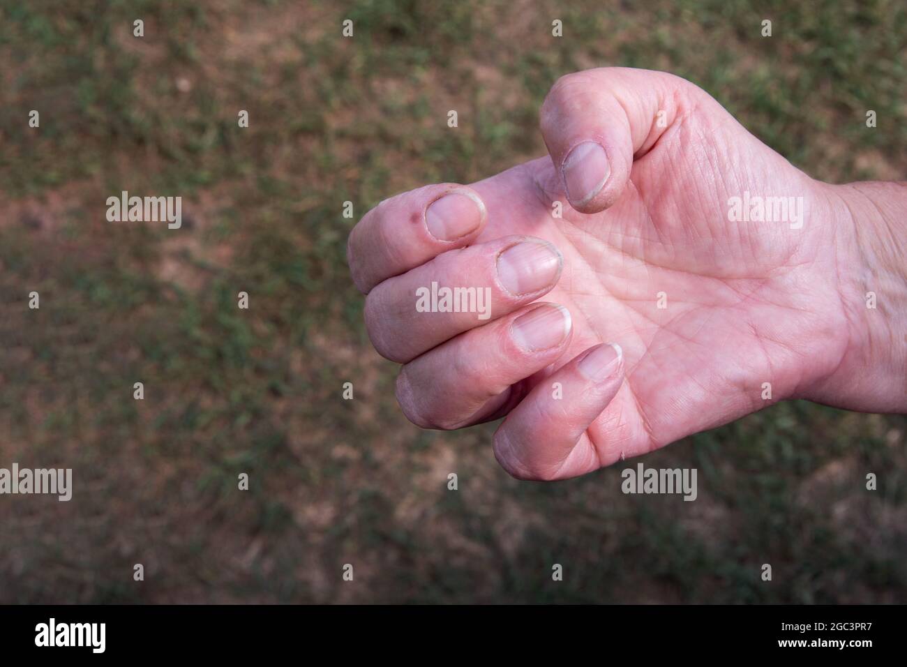 Close-up of short dirty nails, Caucasian female seniors hand on natural ...