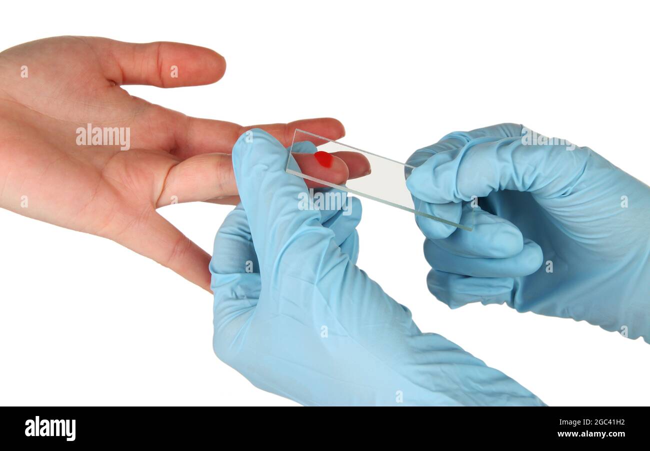 Test tubes with blood in hand isolated on white Stock Photo - Alamy