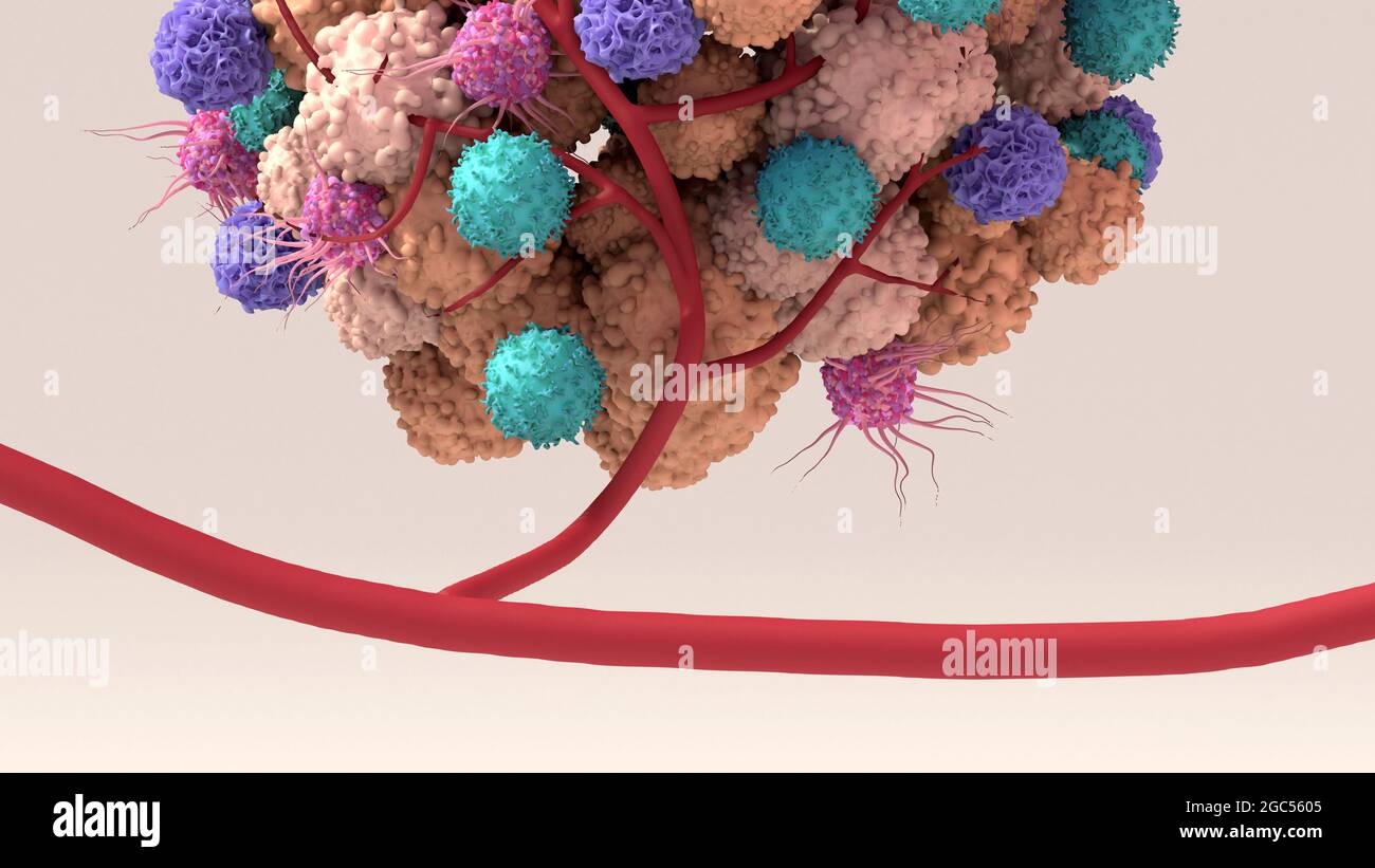 Tumor microenvironment hi-res stock photography and images - Alamy