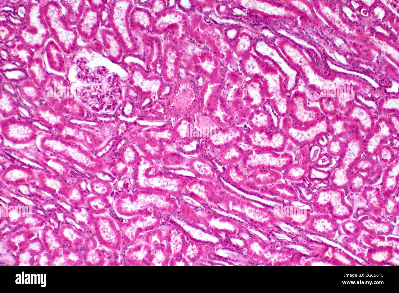 Human kidney tissue, light micrograph Stock Photo - Alamy