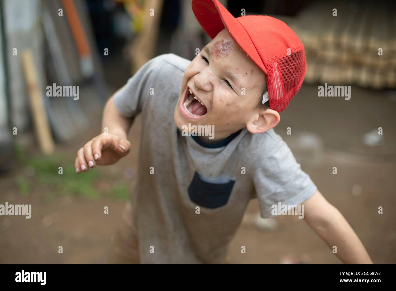 The child grimaces. The boy distorts facial expressions. The ...