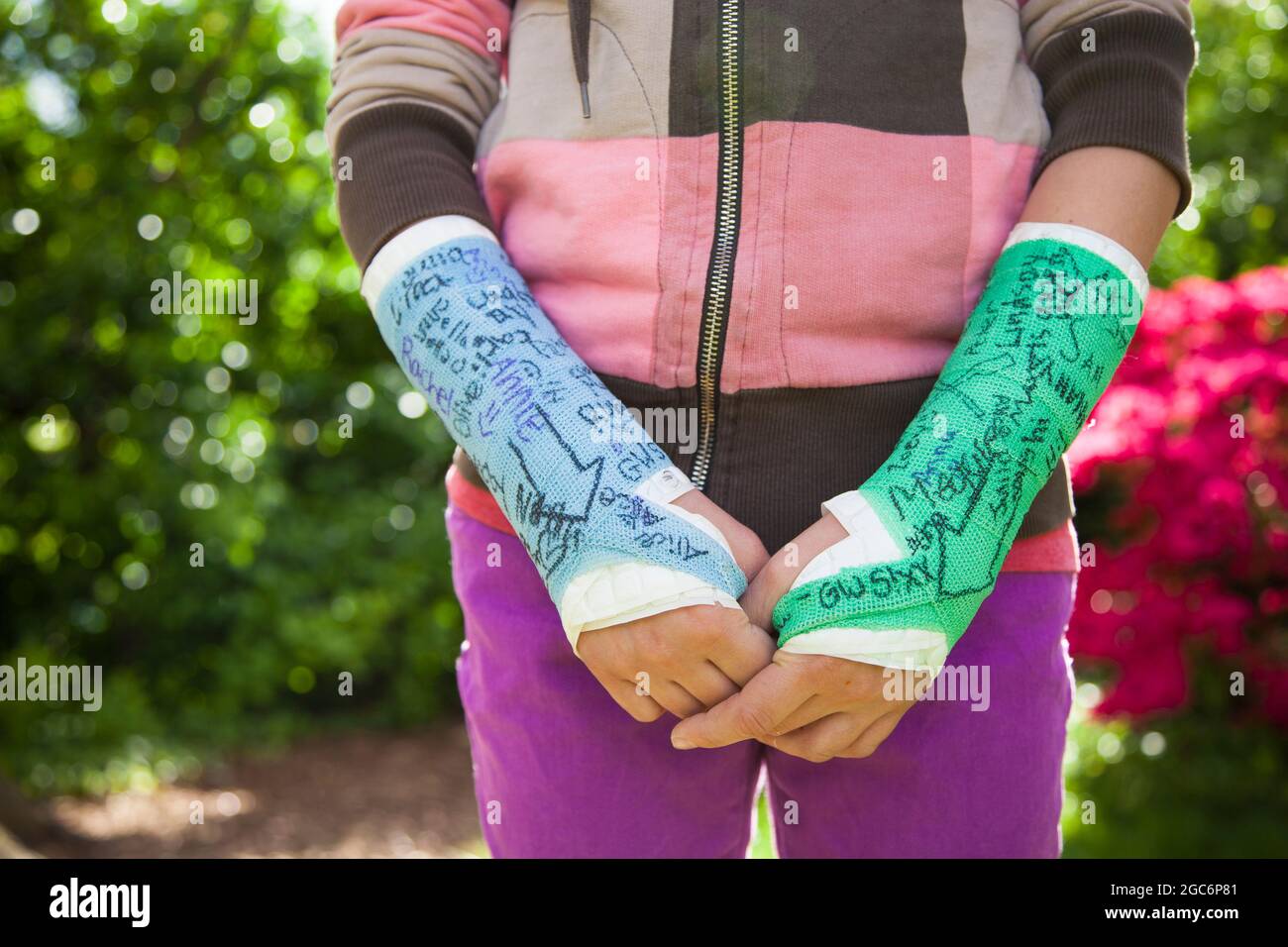 Girl (12-13) with two arm casts Stock Photo - Alamy