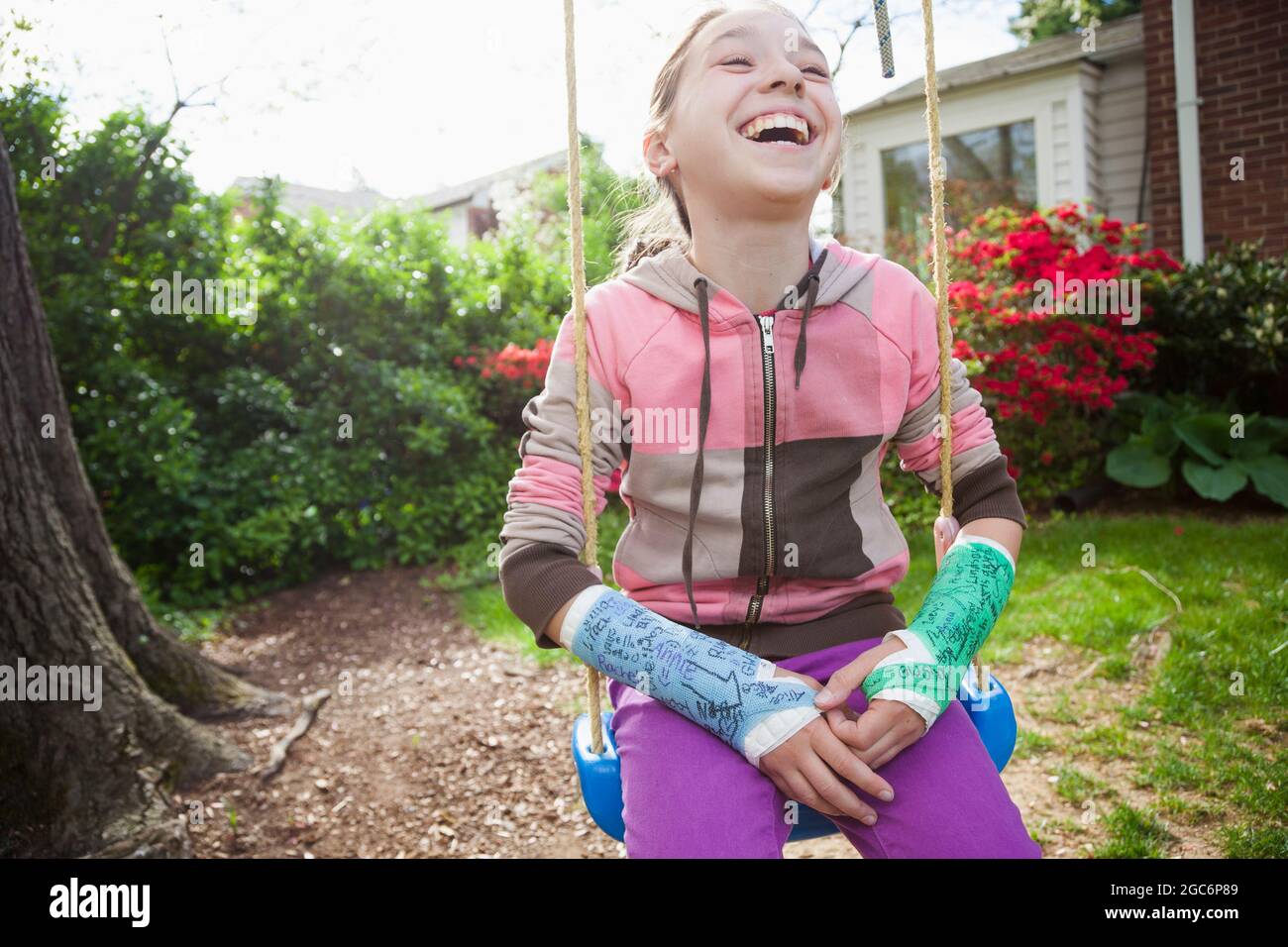 Arm cast girl hi-res stock photography and images - Alamy