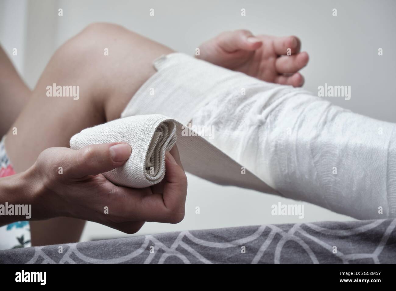 Applying an elastic bandage to a broken leg The leg is in a plaster ...