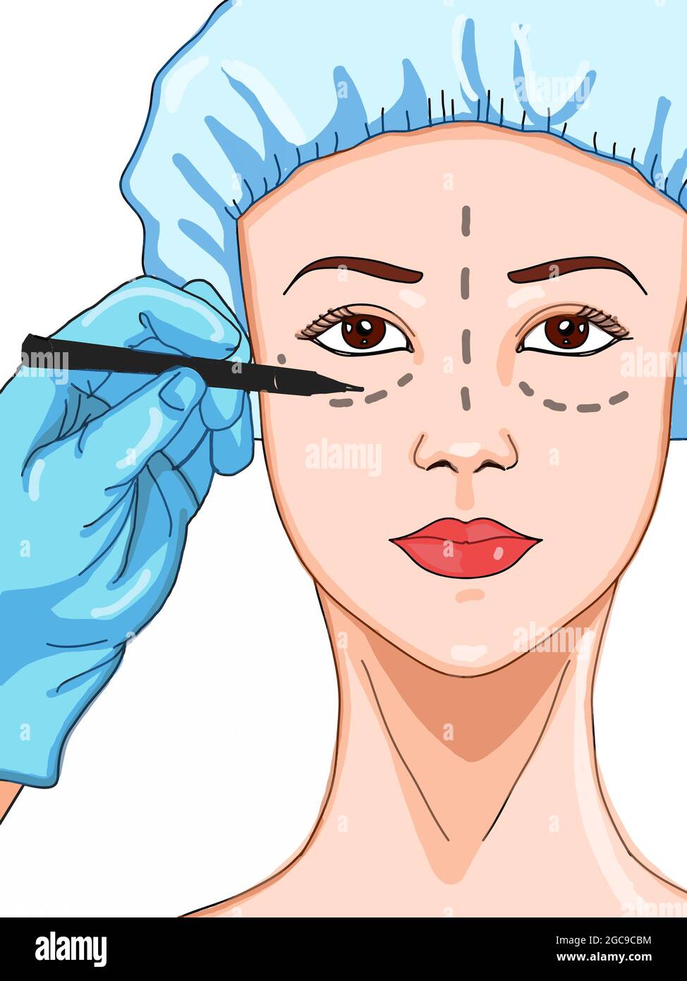 women face ,drawing pencil for lifting injection Stock Photo - Alamy