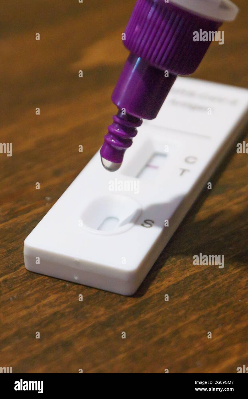 Rapid Covid-19 coronavirus strip test cassette for antibody or sars-cov ...
