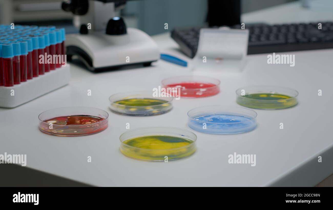 Petri Dish Bacteria Experiment Petri Dish With Bacteria, Living