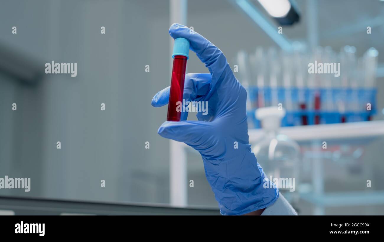 Close up of glass vacutainer filled with dna solution for test in ...