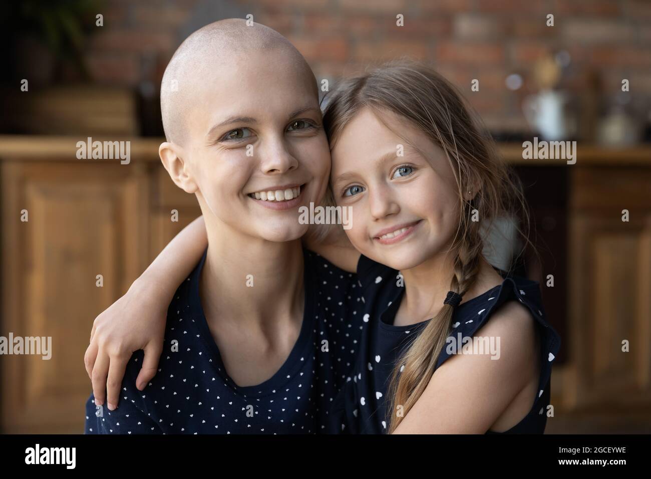Happy cancer mom and lute little daughter hugging at home Stock Photo ...