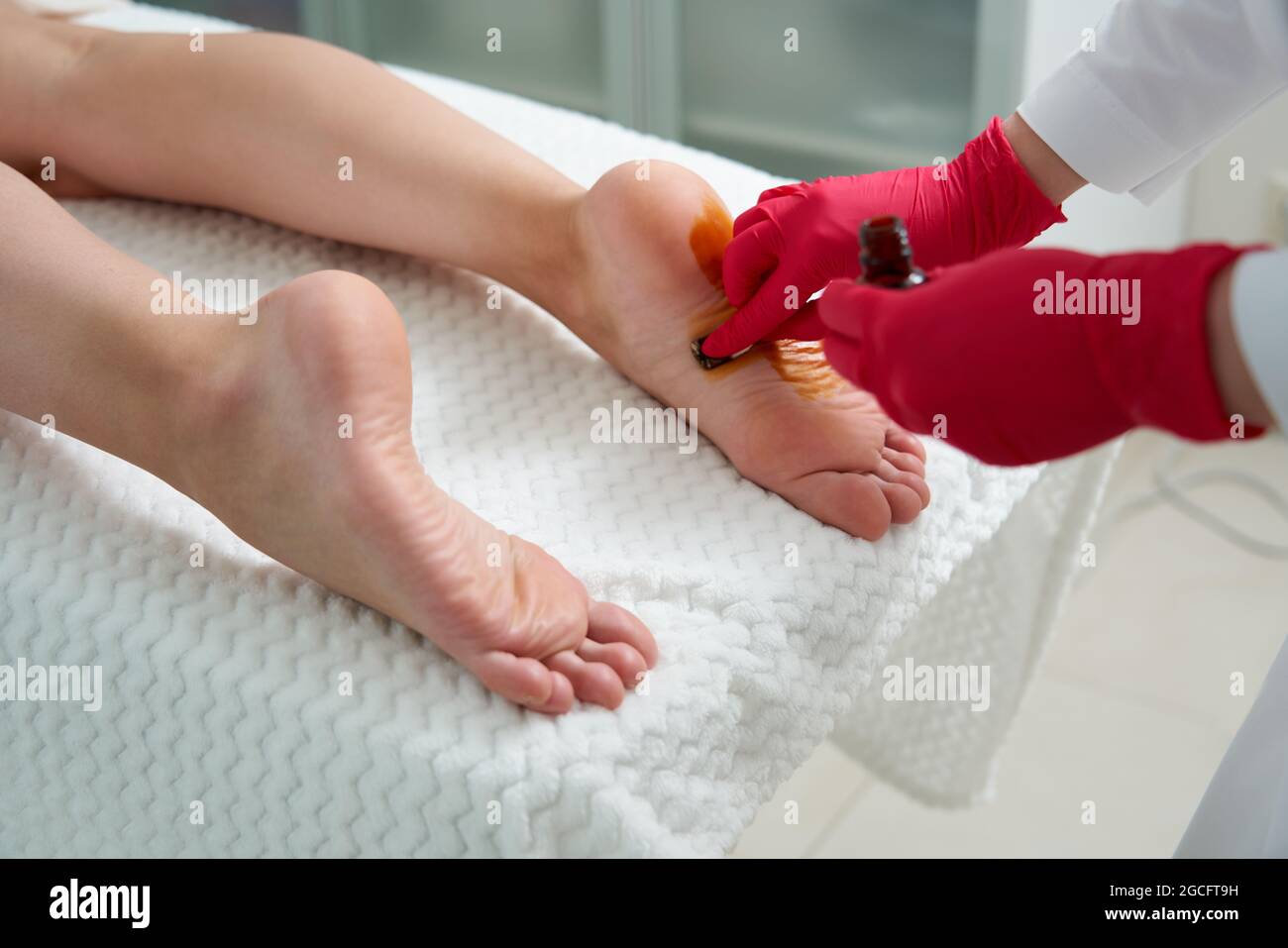 Doctor preparing to make injections of botulinum toxinon in female feet ...