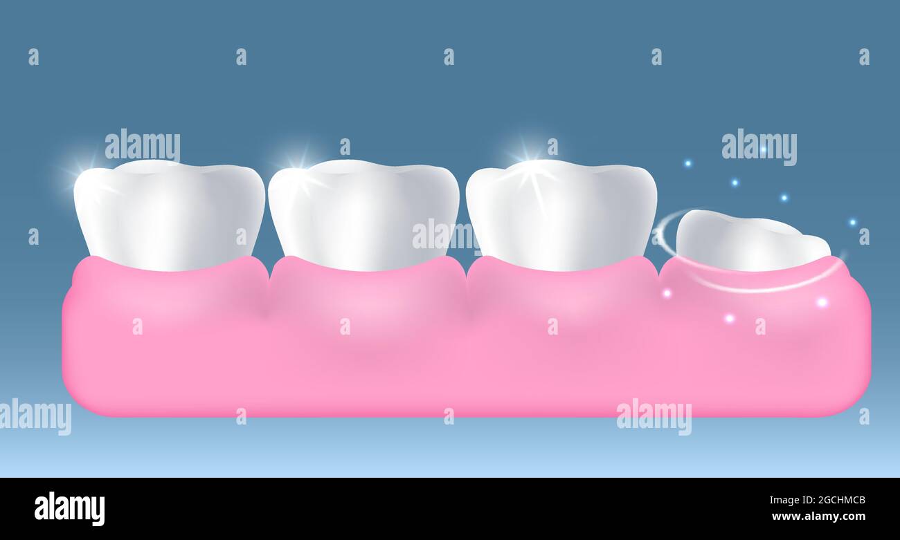Child new teeth growing Stock Vector Images - Alamy